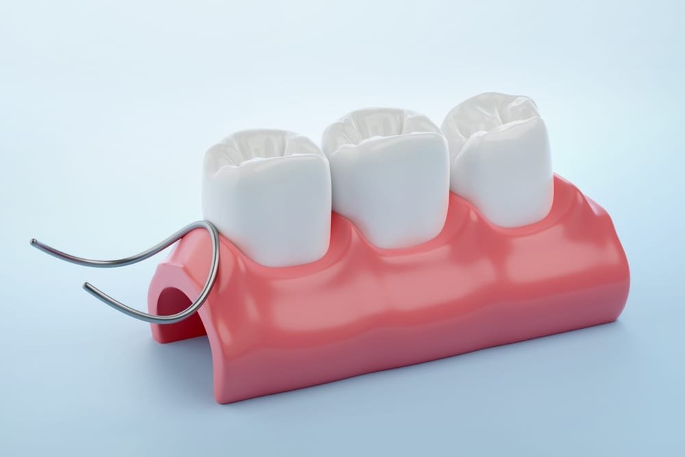 Partial Dentures Before And After - Bay Wellesley Dental